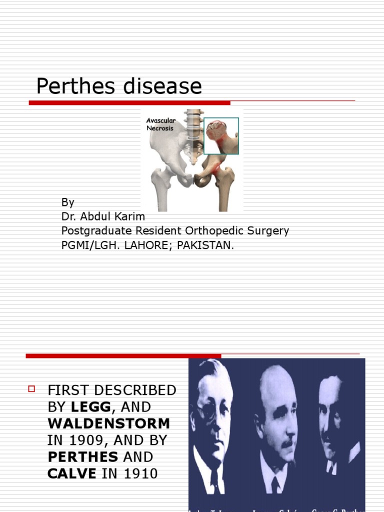 Understanding Perthes Disease in Children | PDF | Science & Mathematics ...