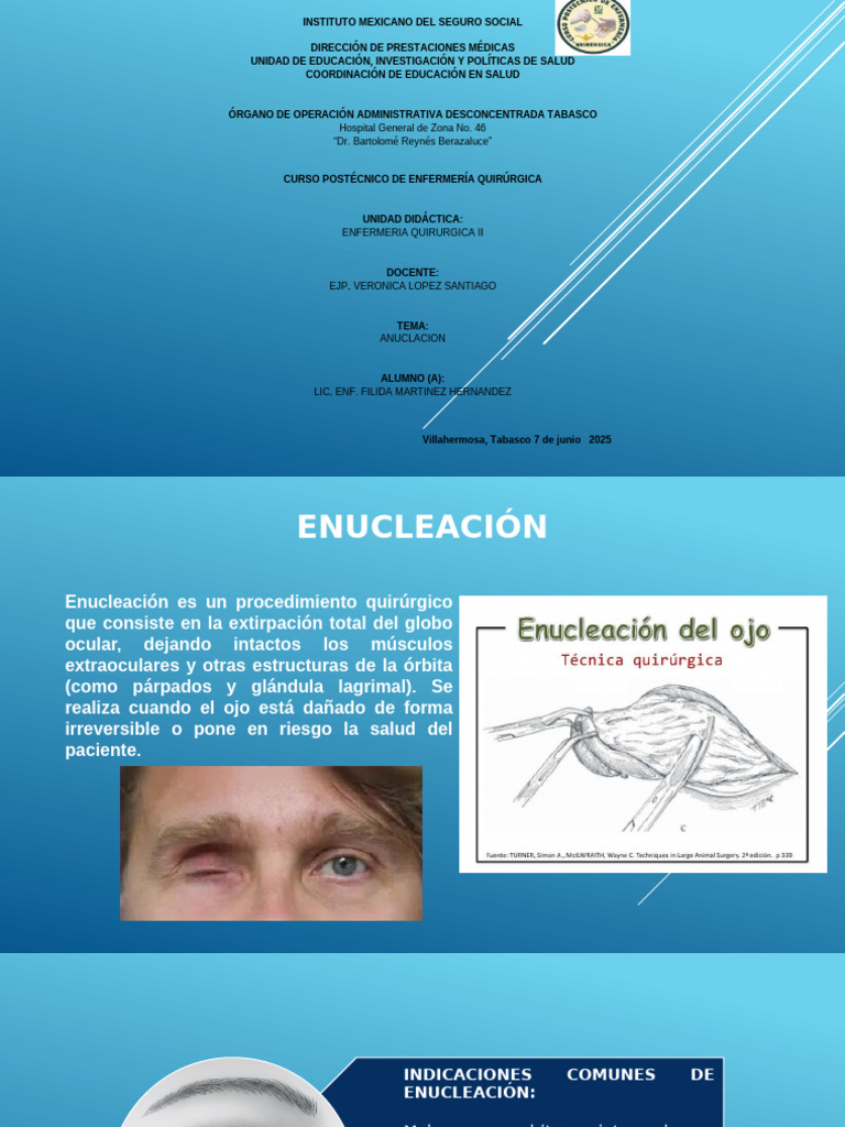 Procedimiento de Enucleación Ocular | PDF | Neoplasias | Medicina CLINICA