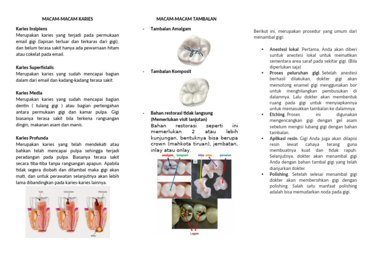 Leaflet Tambalan Gigi | PDF