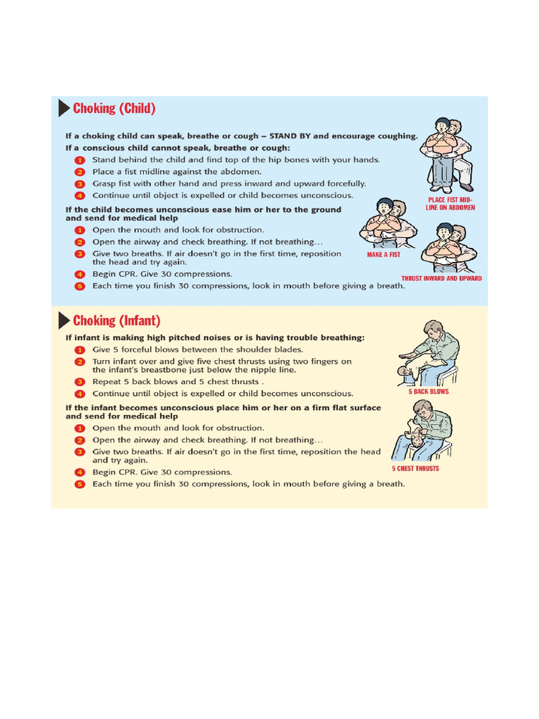 First Aid For Choking Infant and Child | PDF