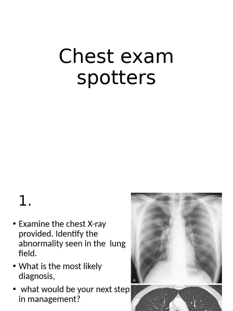 Chest Exam Spotters: Diagnoses & Signs | PDF