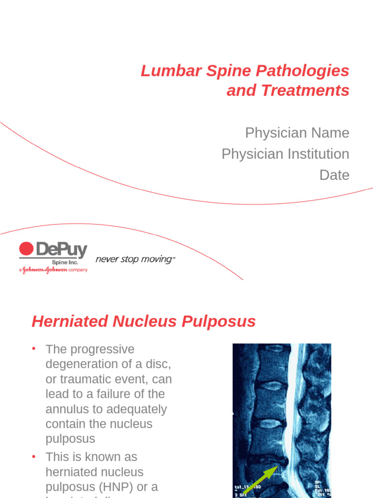 Dysthesias in Lumbar Spine Disorders | PDF | Back Pain ...