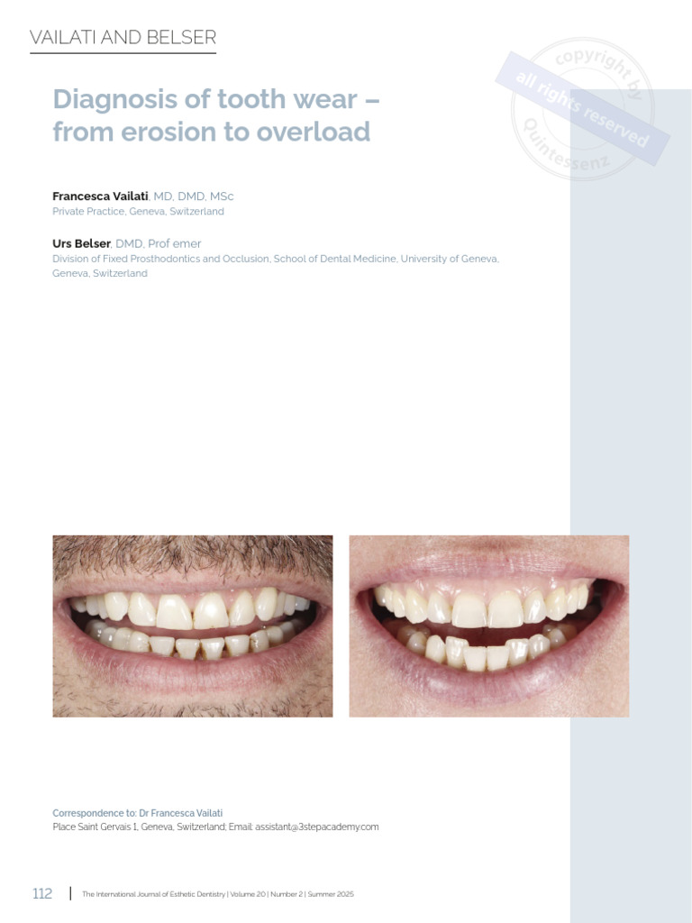 2025 Diagnosis of Tooth Wear From Erosion To Tooth Wear | PDF ...