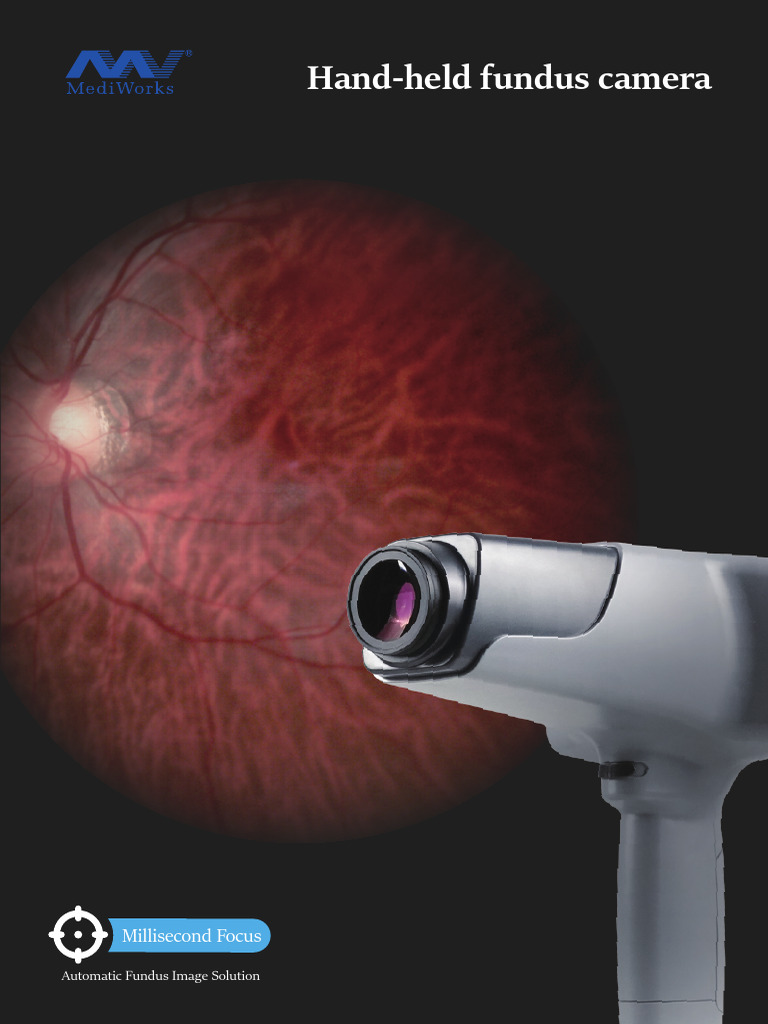 Hand-Held Fundus Camera FC161 | PDF | Autofocus | Imaging