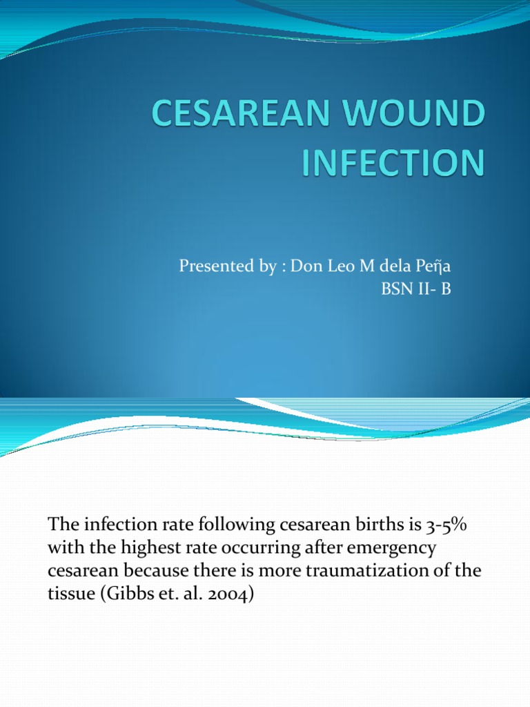Presented By: Don Leo M Dela Pe A BSN Ii-B | PDF | Infection | Wound