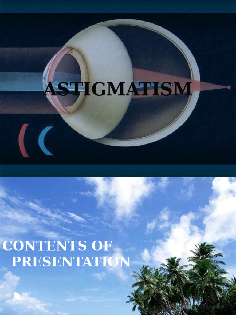 4 Astigmatism | PDF | Optics | Eye