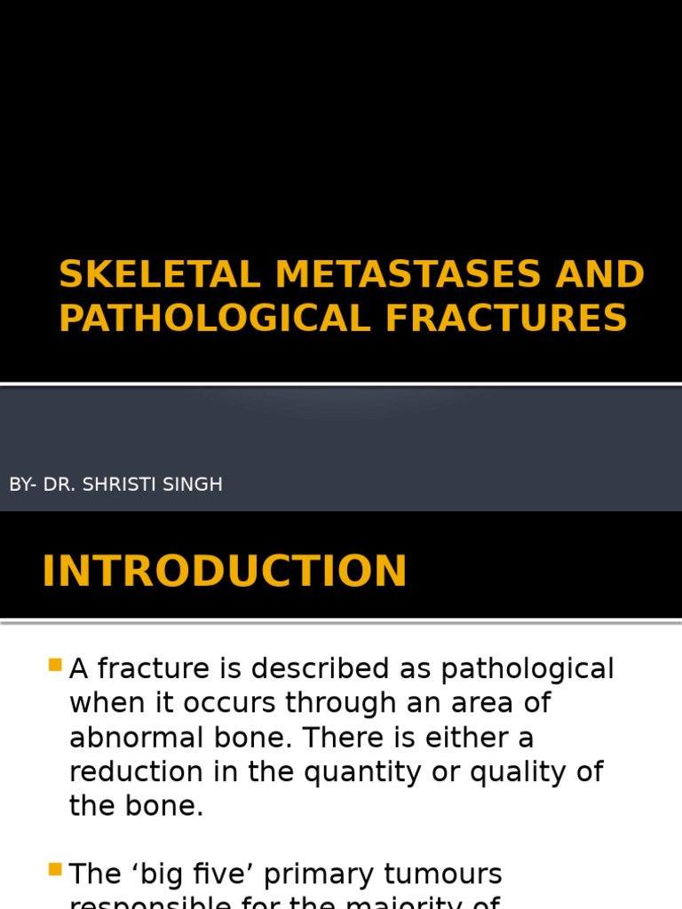Skeletal Metastases and Pathological Fractures | PDF | Metastasis | Bone