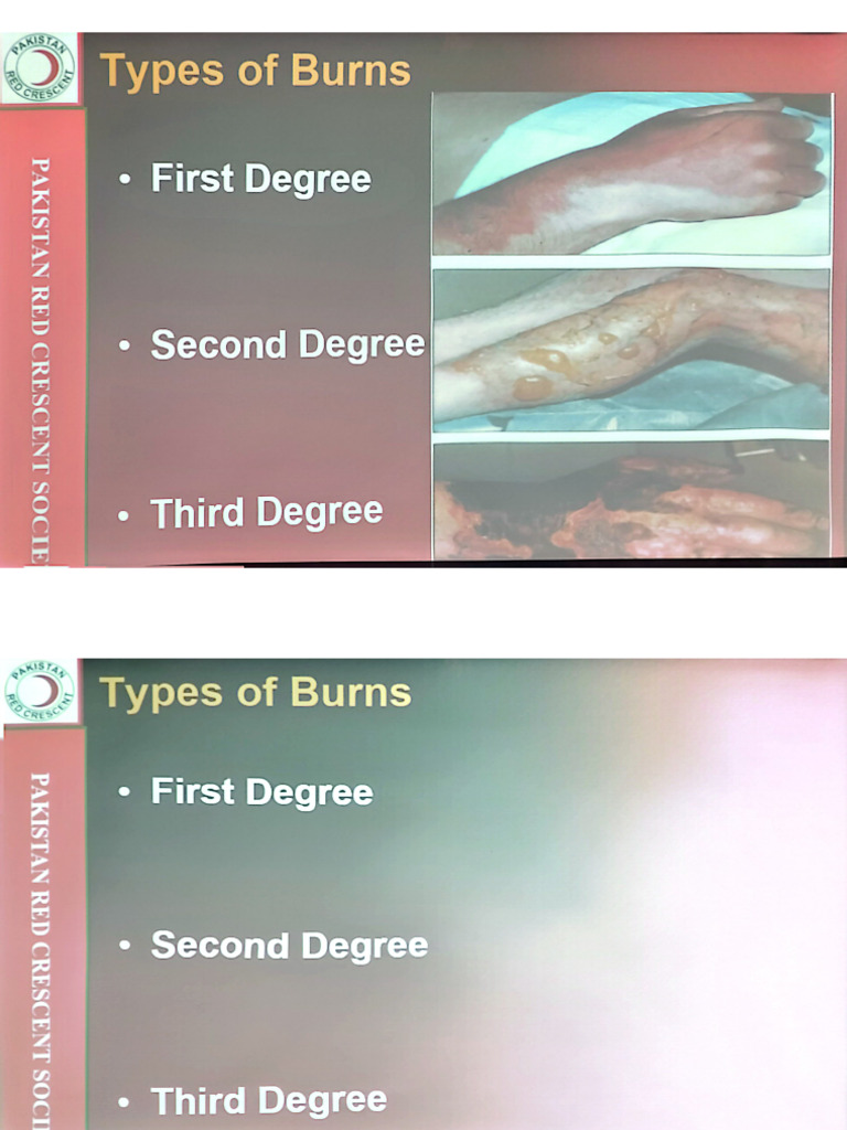 First Aid Red Crescent Course | PDF