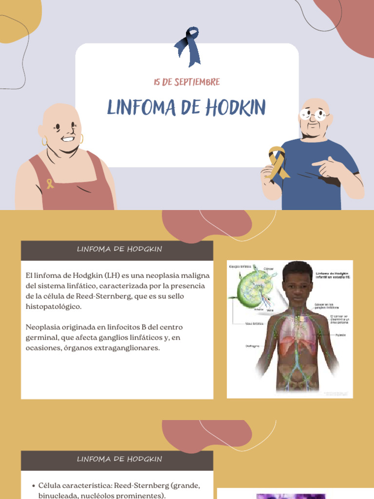 Linfoma de Hodkin | PDF | Linfoma | Ganglio linfático
