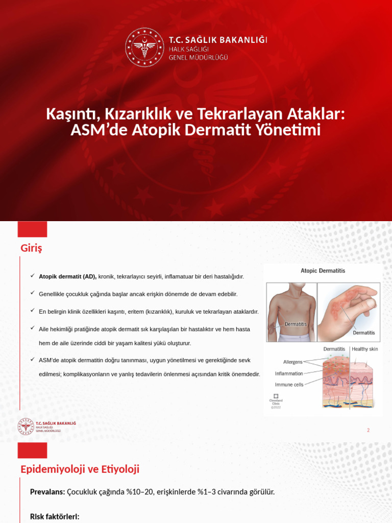 Atopik Dermatit | PDF