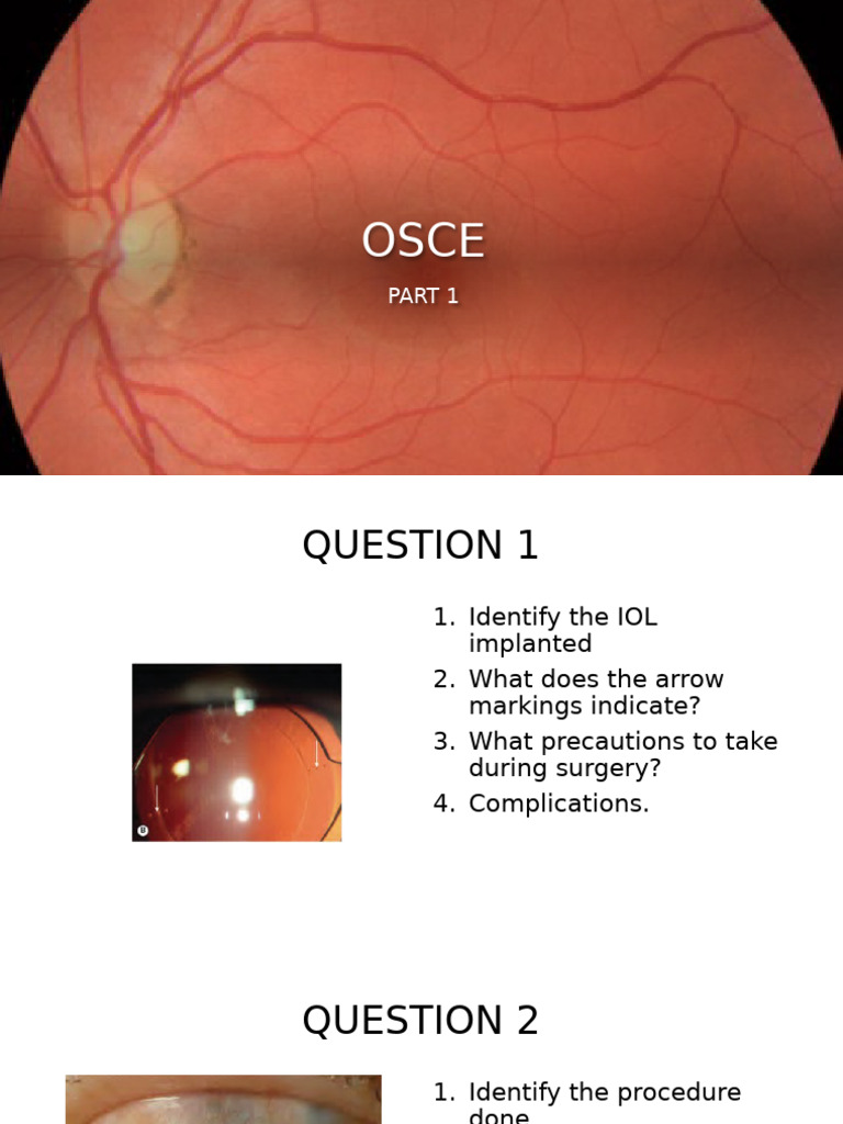 OSCE Exam Questions on Eye Procedures | PDF
