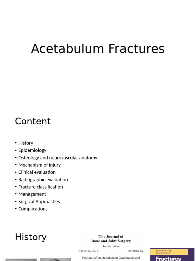 Acetabulum Fractures: Overview & Management | PDF | Hip | Anatomical ...