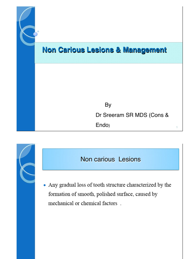 Non-Carious Lesions: Types & Treatment | PDF | Dental Anatomy | Dentistry
