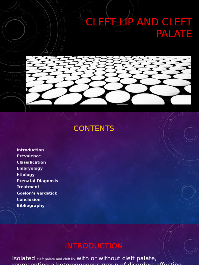 Cleft Lip and Palate Overview | PDF | Dental Implant | Human Tooth