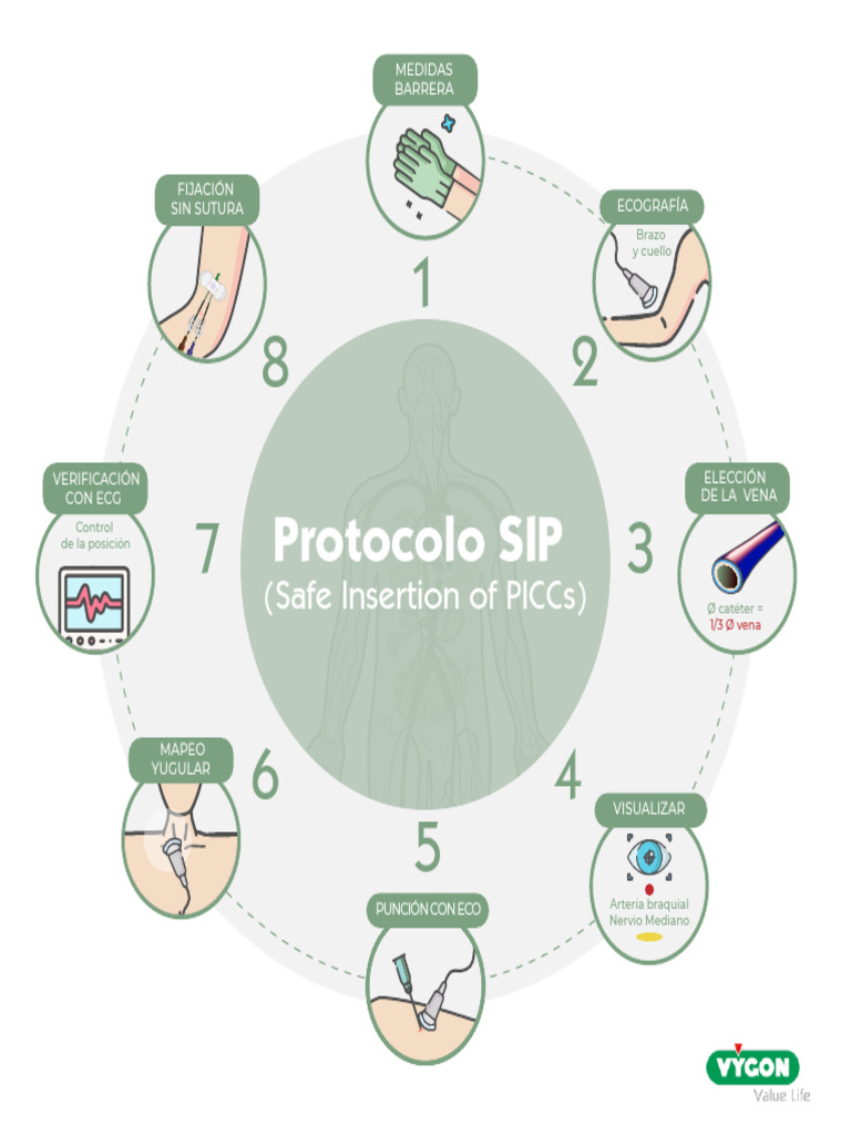 Protocolo SIP para Punción con Eco | PDF