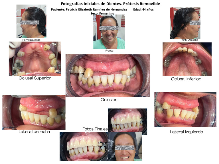 Perio Ii A | PDF