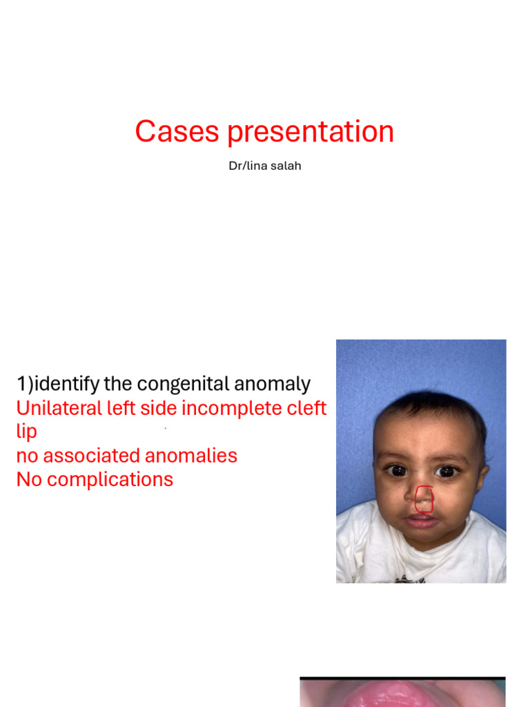 Midterm Practical Plastics | PDF
