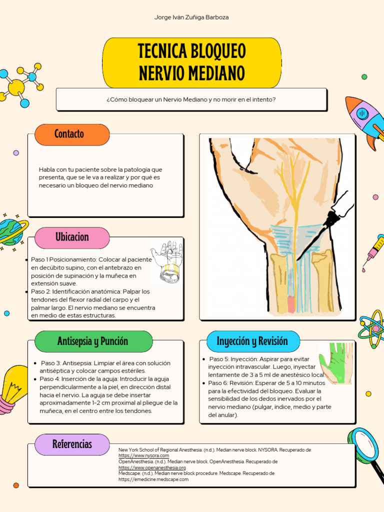Técnica de Bloqueo del Nervio Mediano | PDF | Inyección (medicina ...