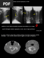 Radiographie de la cheville et du pied | PDF | Pied | Système squelettique