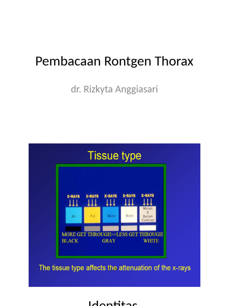 Panduan Rontgen Thorax Lengkap | PDF