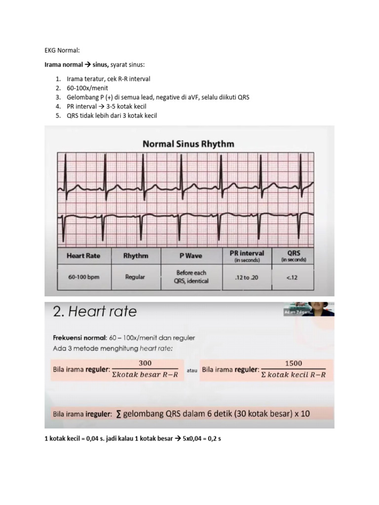 Panduan Interpretasi EKG Normal dan Anomali | PDF