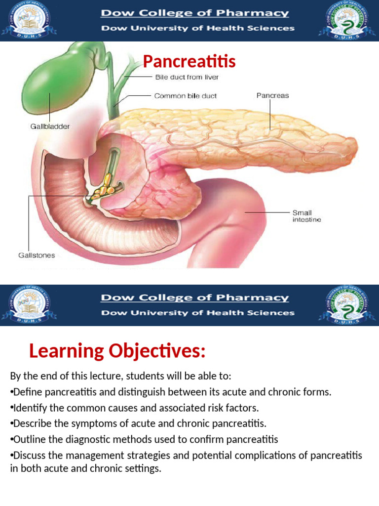 Understanding Pancreatitis: Types and Management | PDF | Pancreas ...