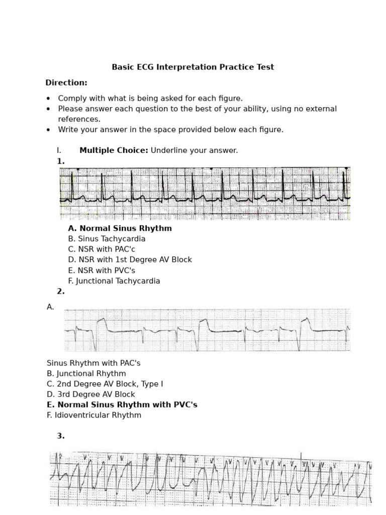 Basic ECG Interpretation Practice Test - ANSWER SHEET | PDF