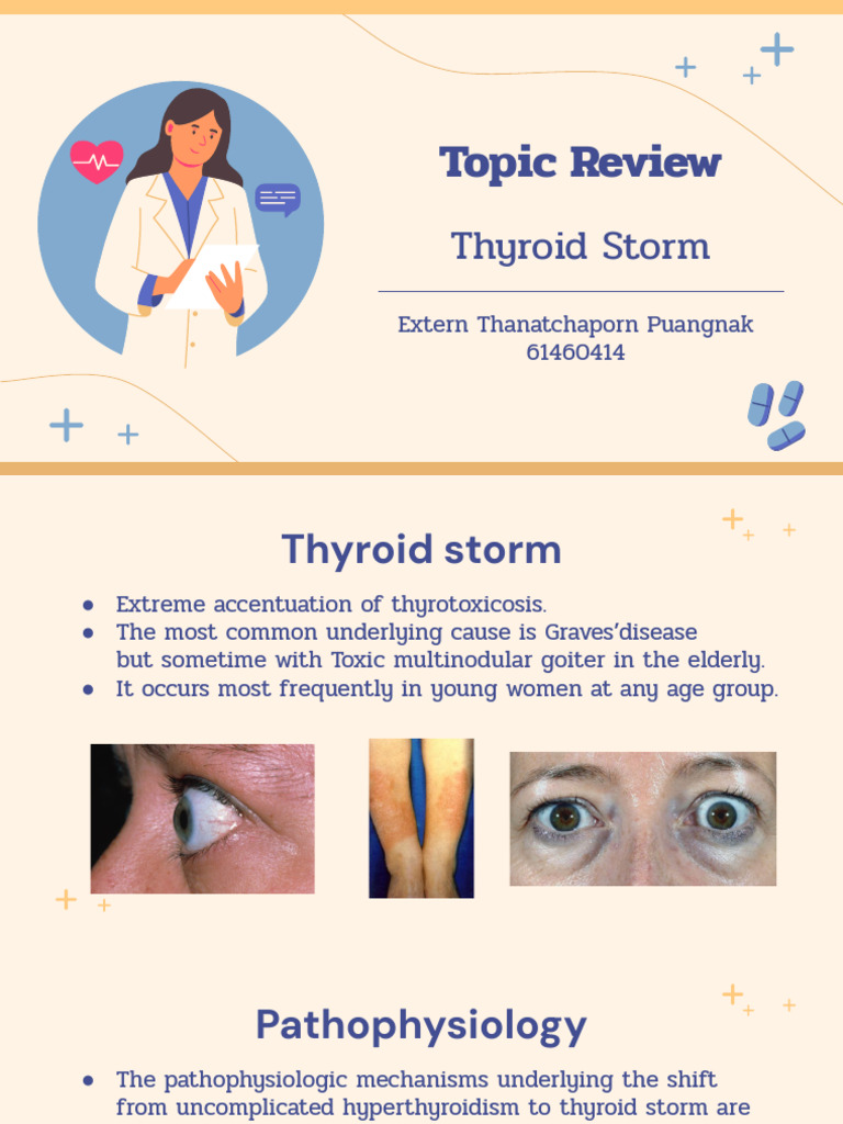Understanding Thyroid Storm: Causes & Management | PDF ...