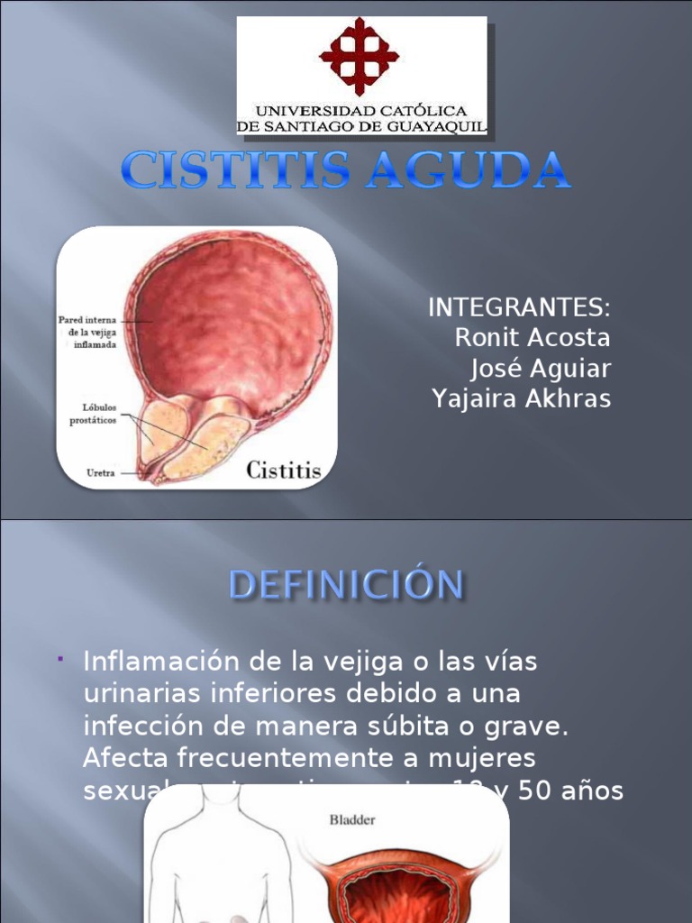 Cistitis Aguda: Causas y Síntomas | PDF | Sistema urinario | Vejiga ...