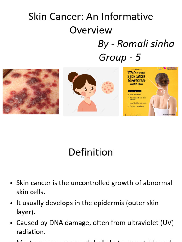 Comprehensive Skin Cancer Overview | PDF | Skin Cancer | Melanoma