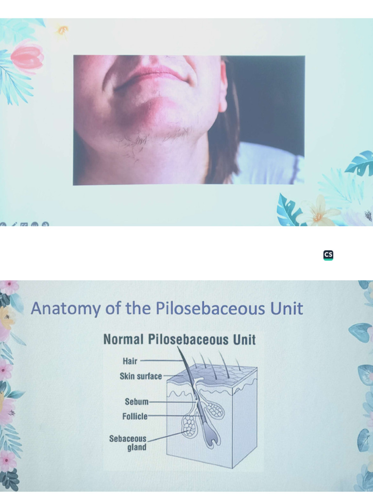 PCOS PPT 3rd Year Med Study Material | PDF