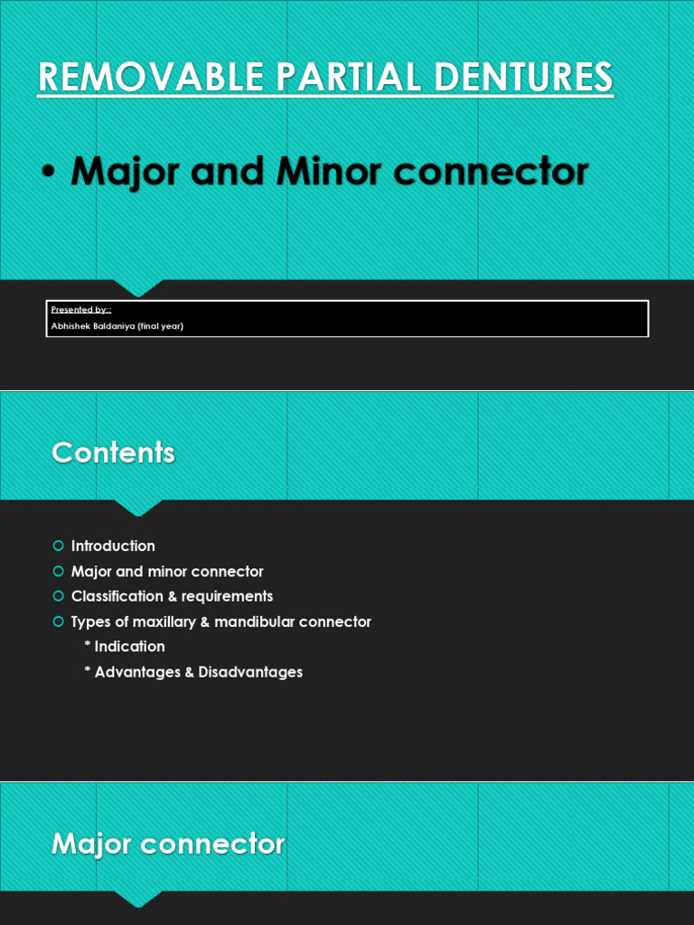 Major and Minor Connector | PDF | Dentures | Tooth