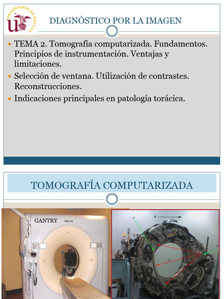 Tema 2. Tomografía Computarizada. | PDF | Ct Scan | Especialidades Medicas