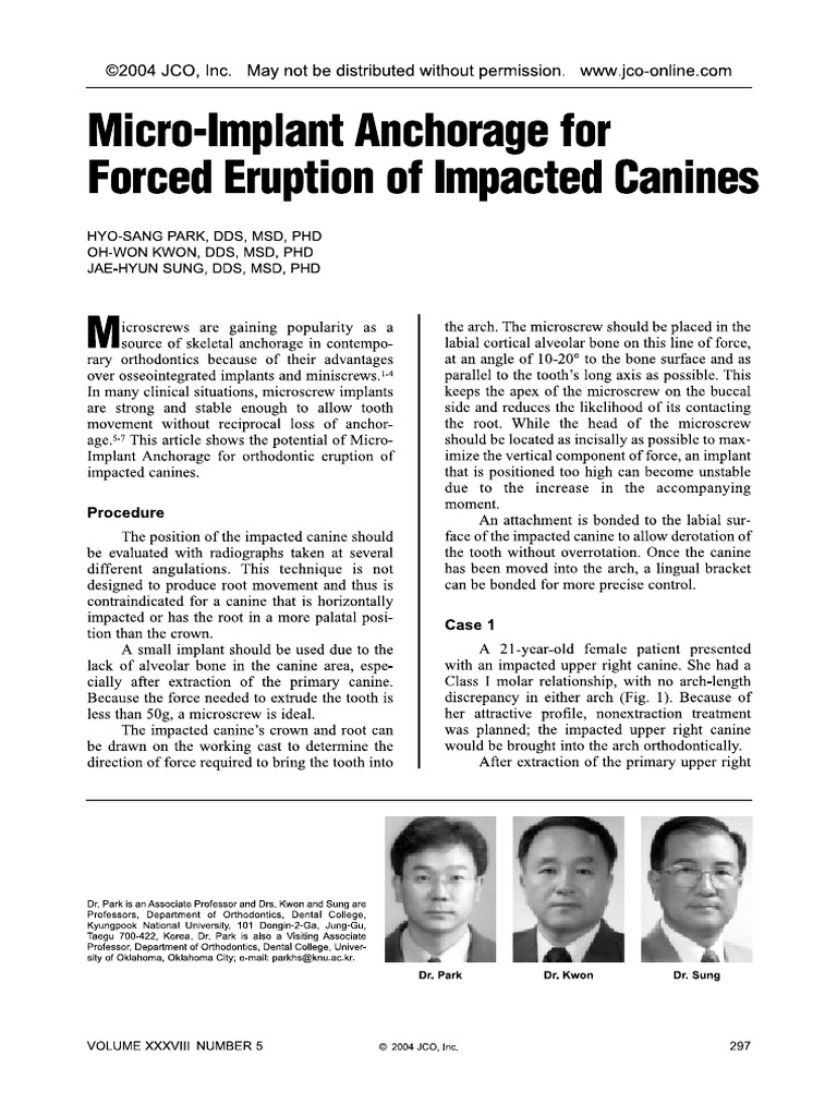 Disimpact Canines Using Tads | PDF