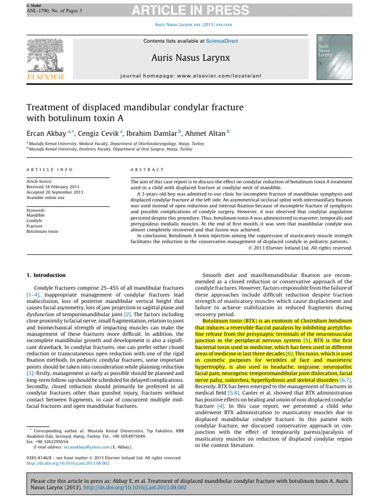 Treatment of Displaced Mandibular Condylar Fracture With Botox | PDF ...