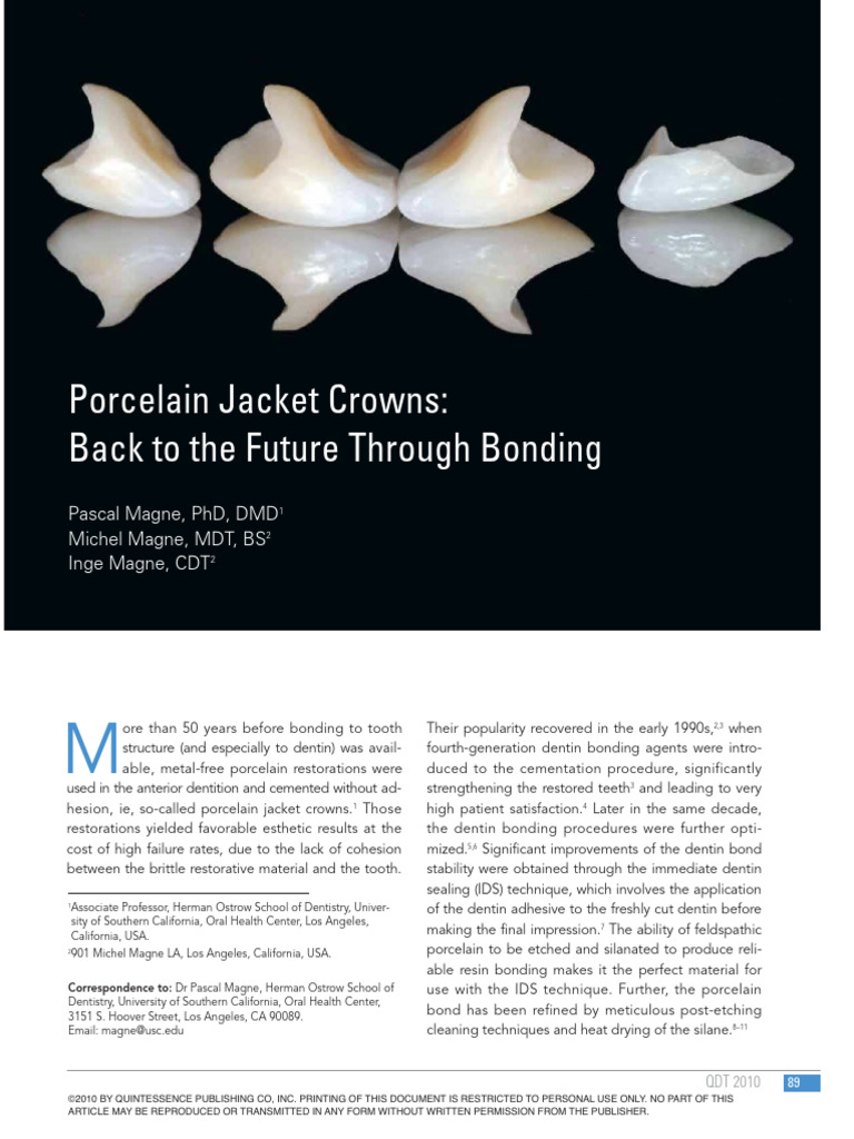 Porcelain Jacket Crowns Back To The Futu | PDF | Dentistry Branches ...