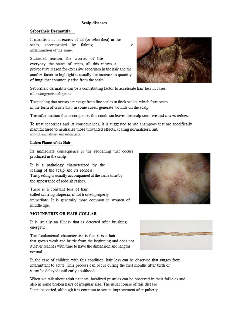 Scalp Diseases | PDF | Hair Loss | Cutaneous Conditions