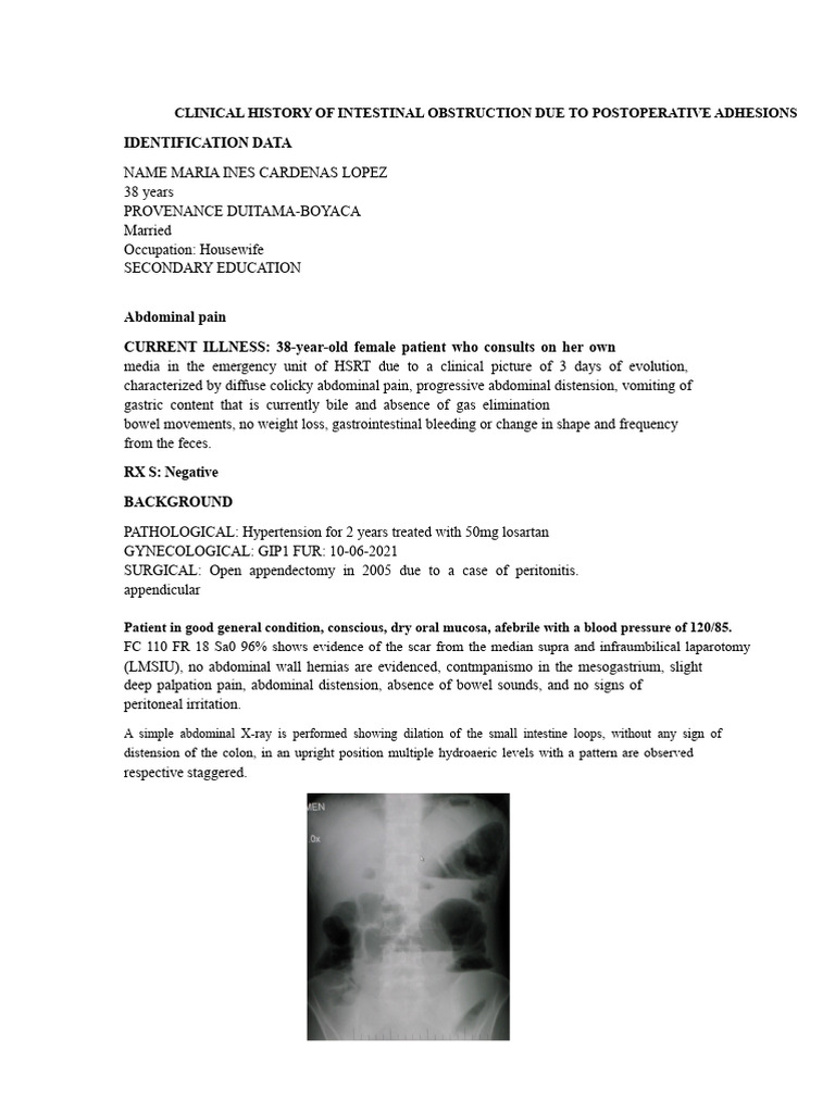 Clinical History of Intestinal Obstruction Due To Postoperative Bridle ...