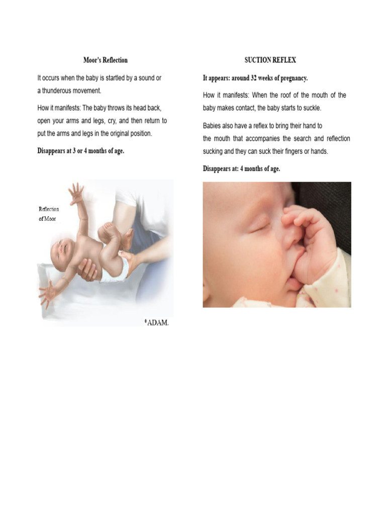 Infant Reflexes Overview | PDF | Reflexes