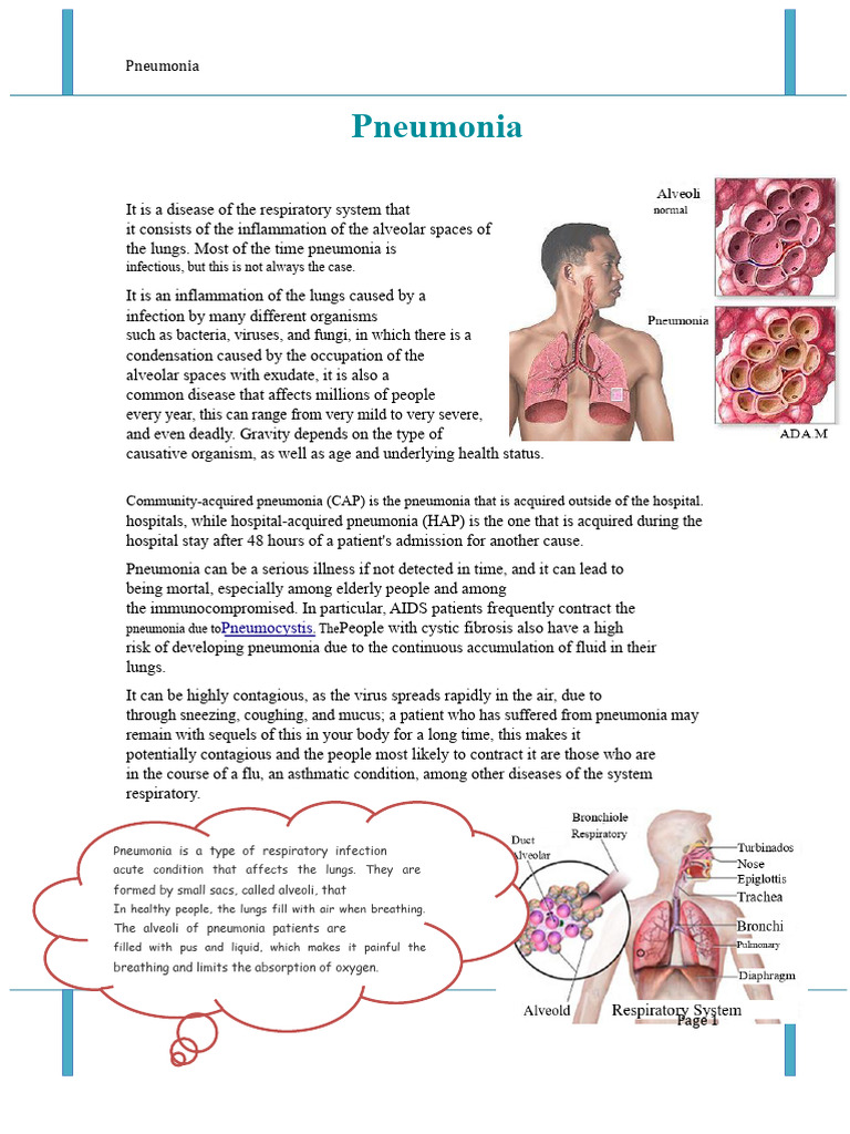 Pneumonia | PDF | Pneumonia | Respiratory Diseases