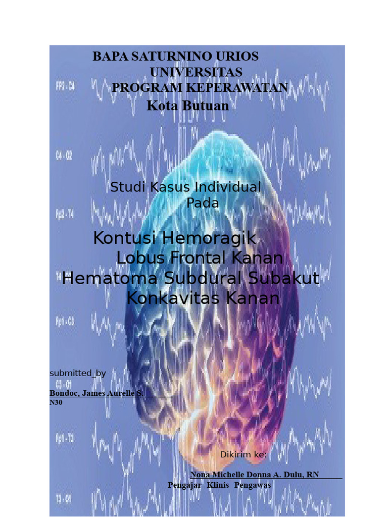 Kontusi Hemoragik dan Hematoma Subdural | PDF