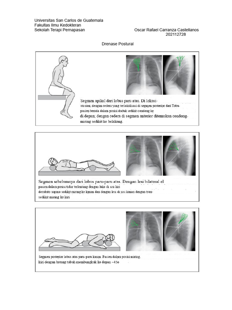 Drainase Postural | PDF