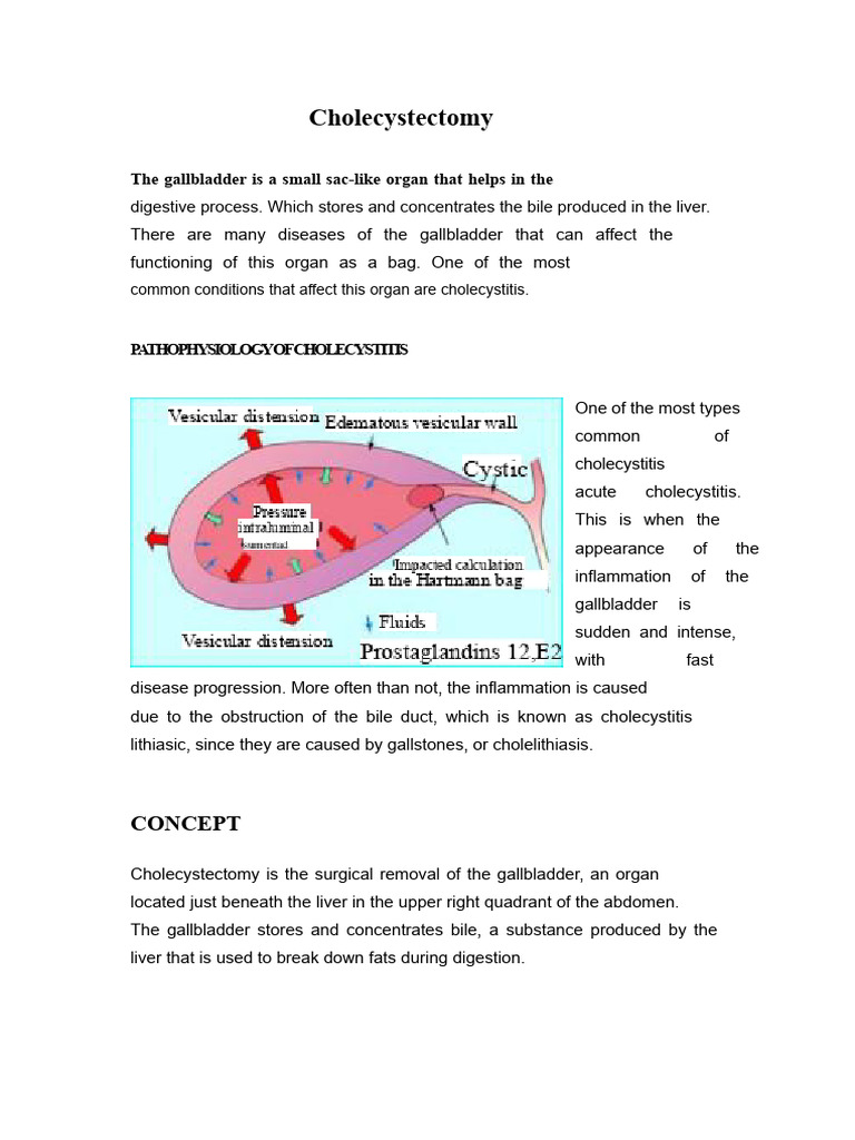 Cholecystectomy: Types and Care Guide | PDF | Gallbladder | Medical ...