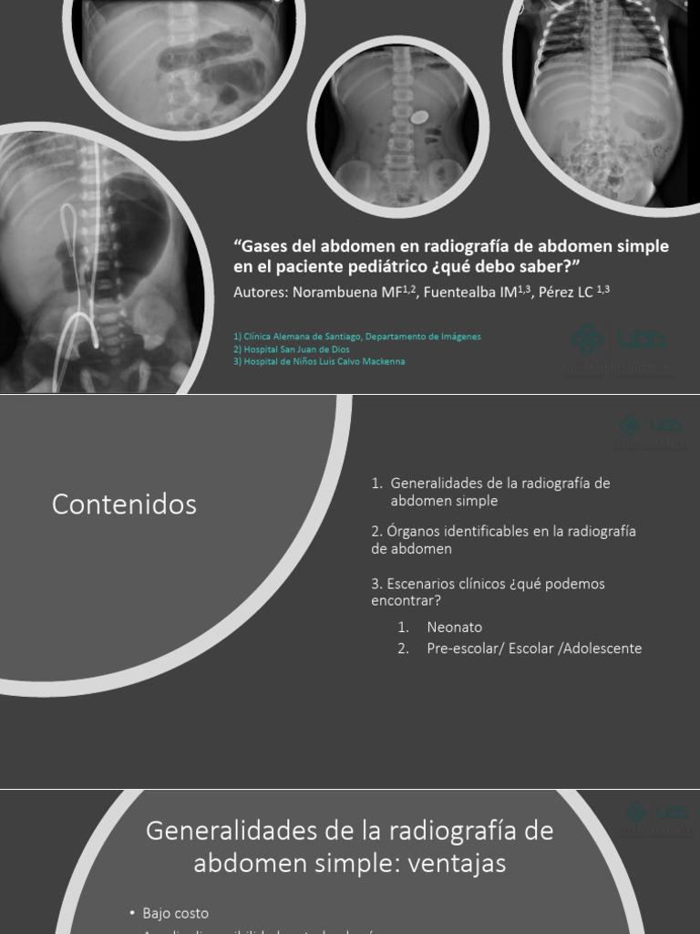 Poster RX Abdomen CCHR 2022 Gases Del Abdomen Final 1 | PDF | Tracto ...