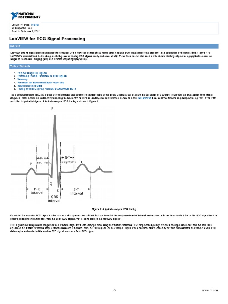 Labview For Ecg Signal Processing: Tutorial | PDF | Electrocardiography ...