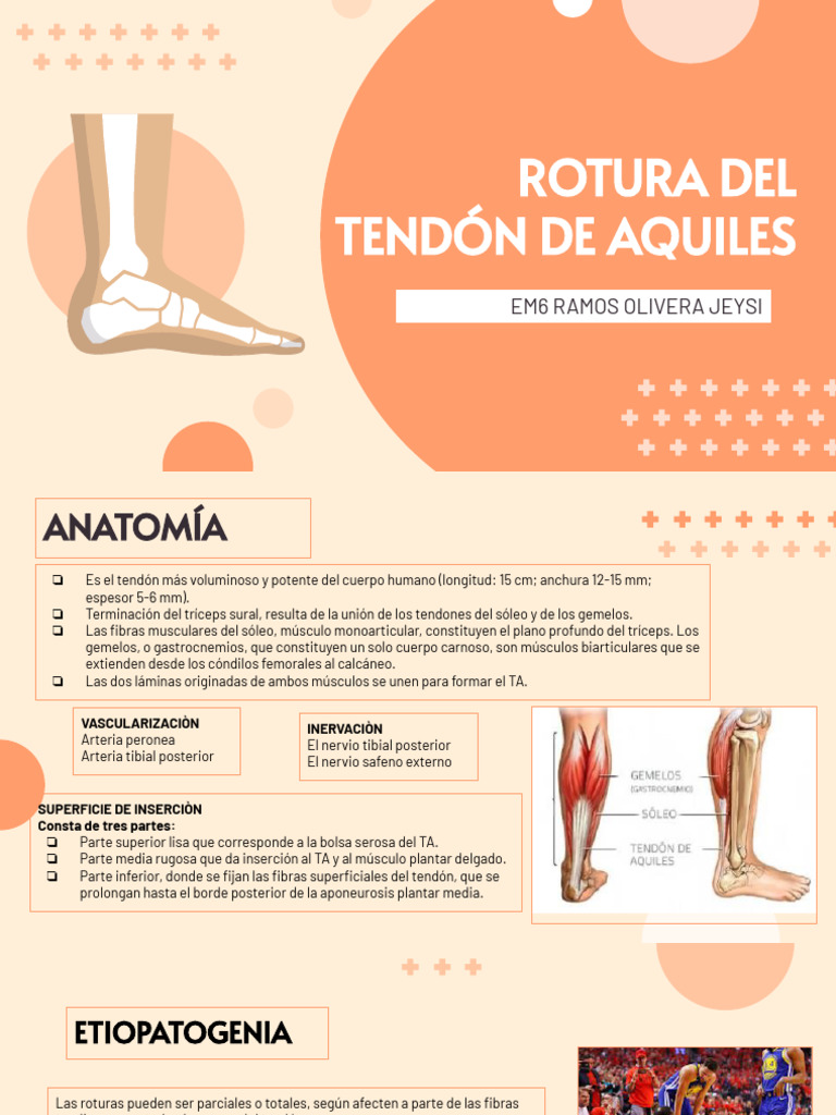 Rotura del Tendón de Aquiles: Causas y Tratamiento | PDF ...