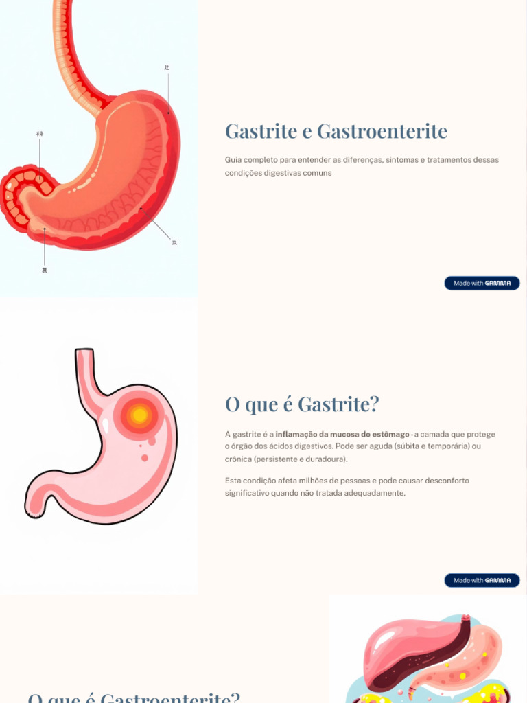 Gastrite vs Gastroenterite: Diferenças e Sintomas | PDF | Enfermedades ...