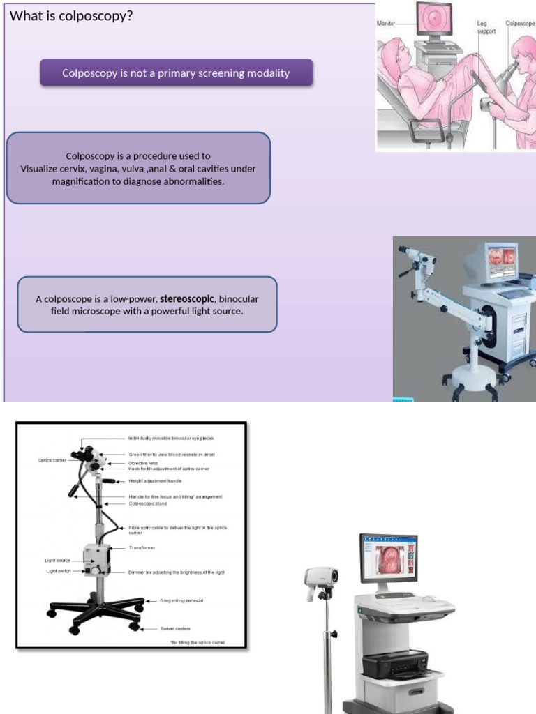 Colposcopy Overview and Procedure Guide | PDF | Cervical Cancer ...