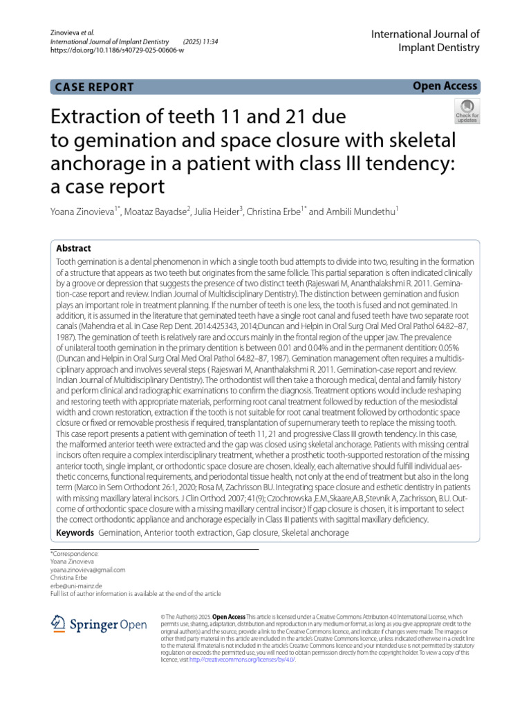 Extraction of Teeth 11 and 21 Due To Gemination and Space Closure With ...