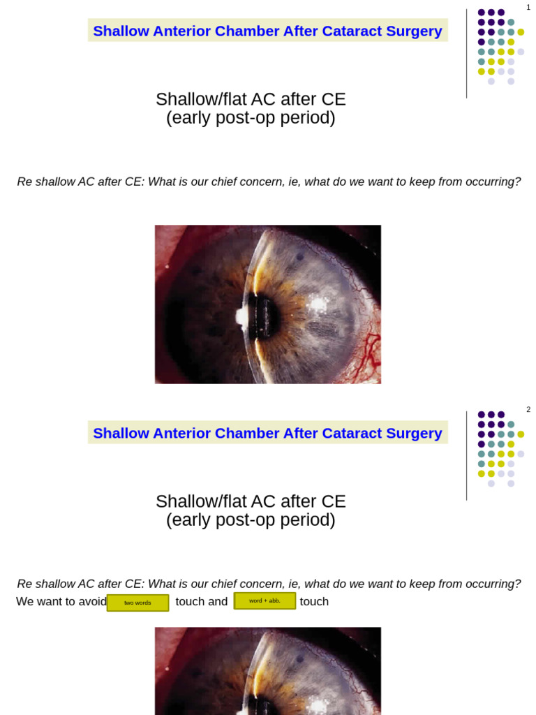 L8u - Shallow Anterior Chamber After Cataract Surgery | PDF | Cataract ...